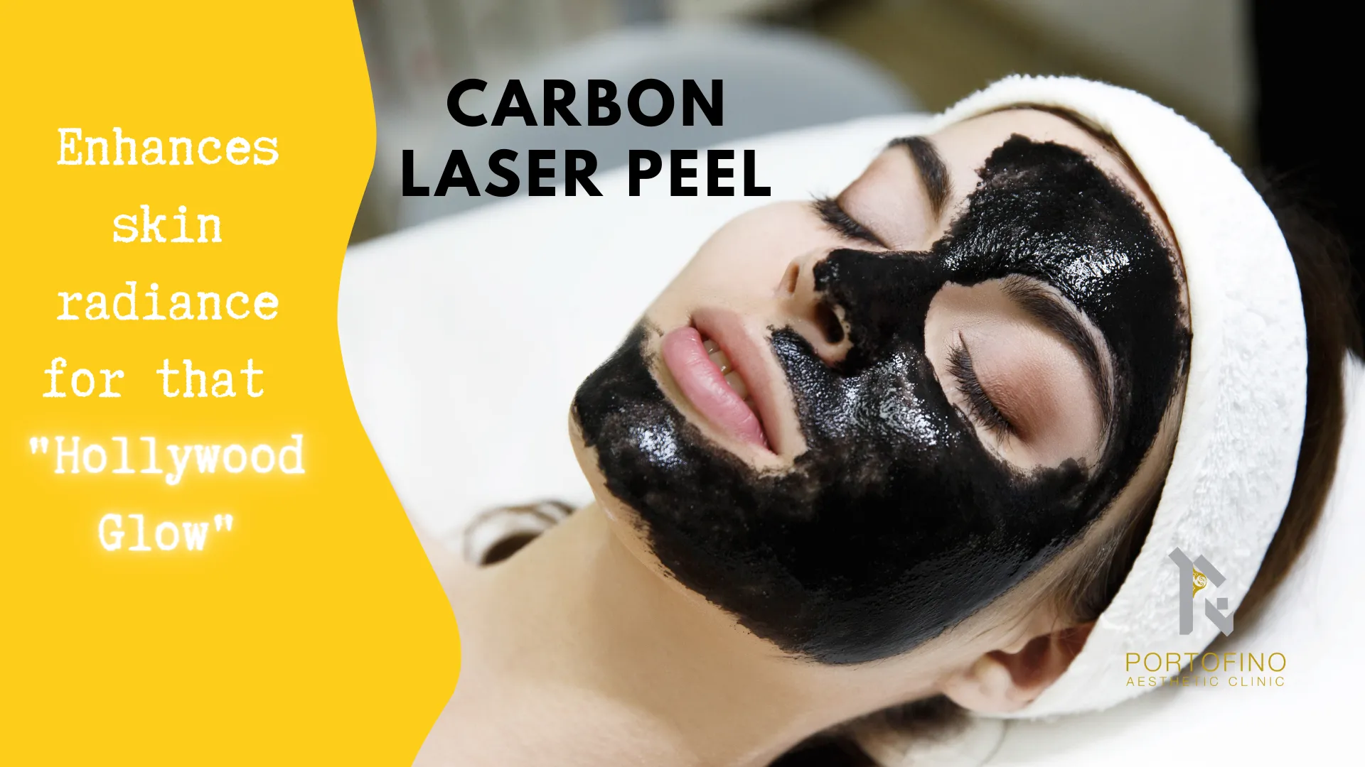 Carbon Peel Laser Treatment [Hollywood Glow] - Portofino