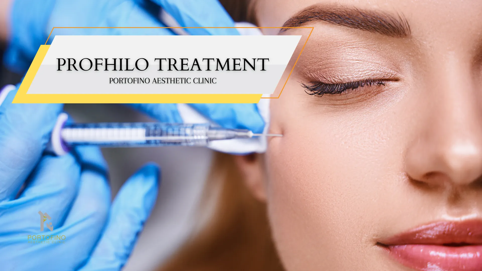 Profhilo Treatment In Dubai [Best]- Portofino Clinic