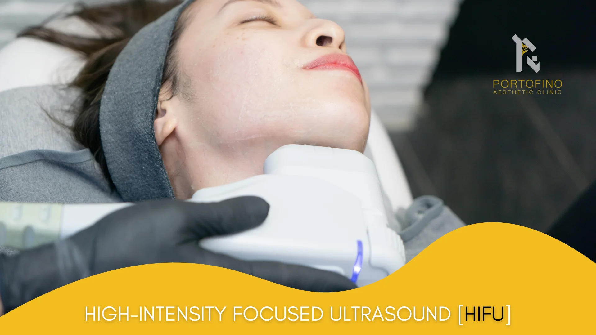Best HIFU Treatment in Dubai- Portofino Aesthetic Clinic
