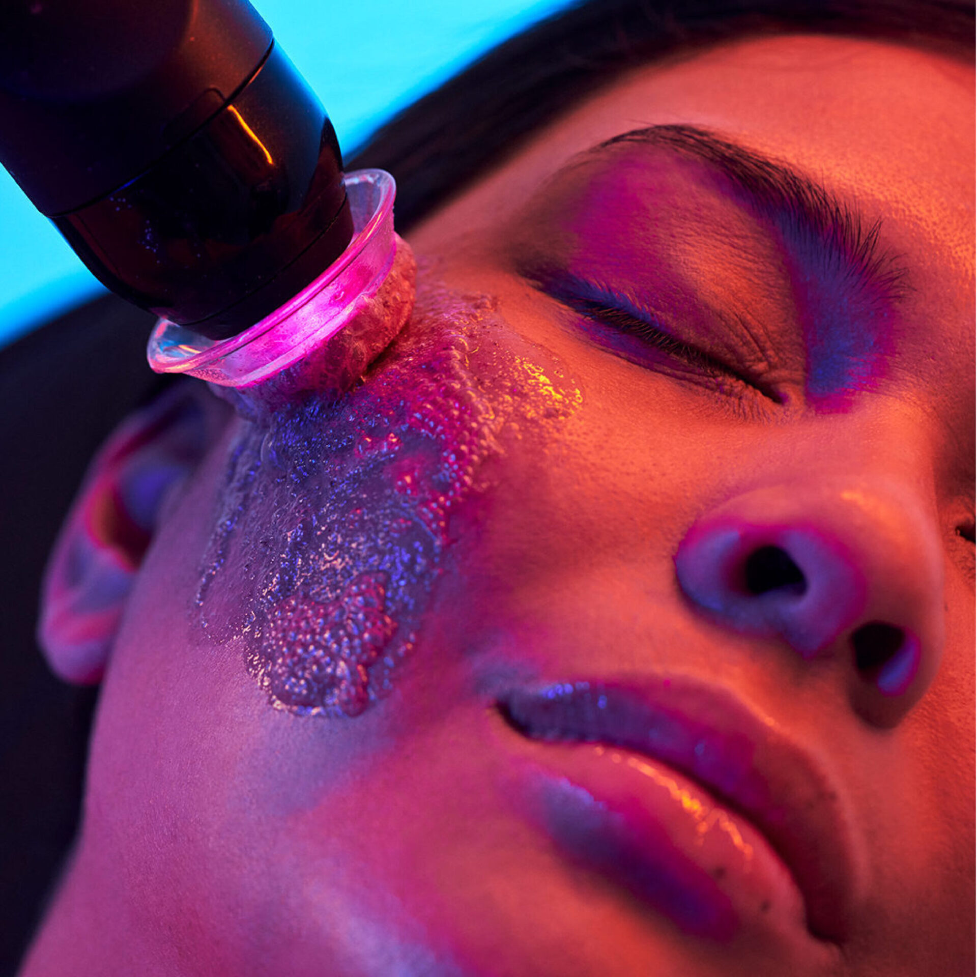 OxyGeneo® Treatment Dubai | Skin Rejuvenation & AntiAging